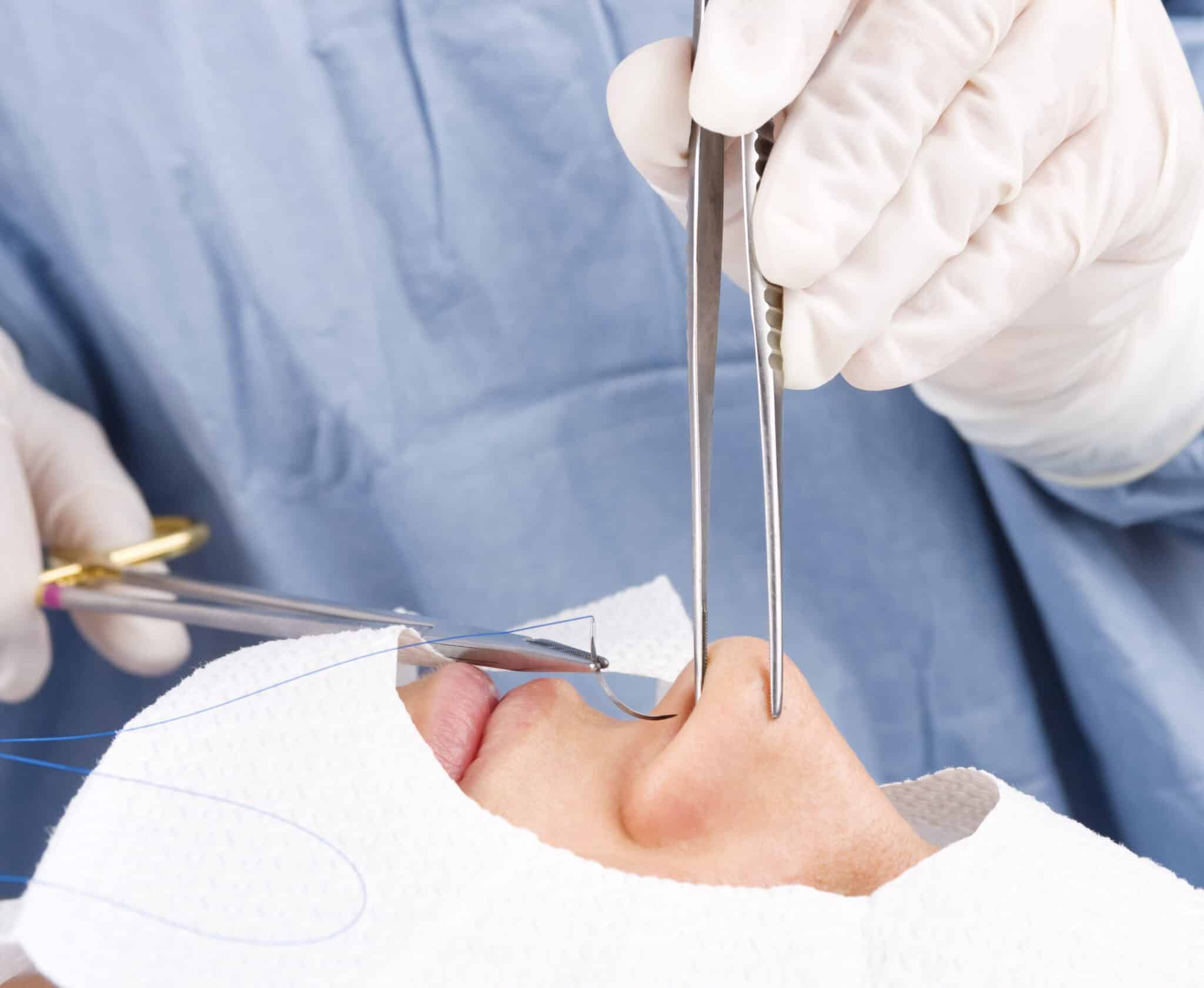 Rhinoplasty Houston TX - Nose Job Surgery Houston TX